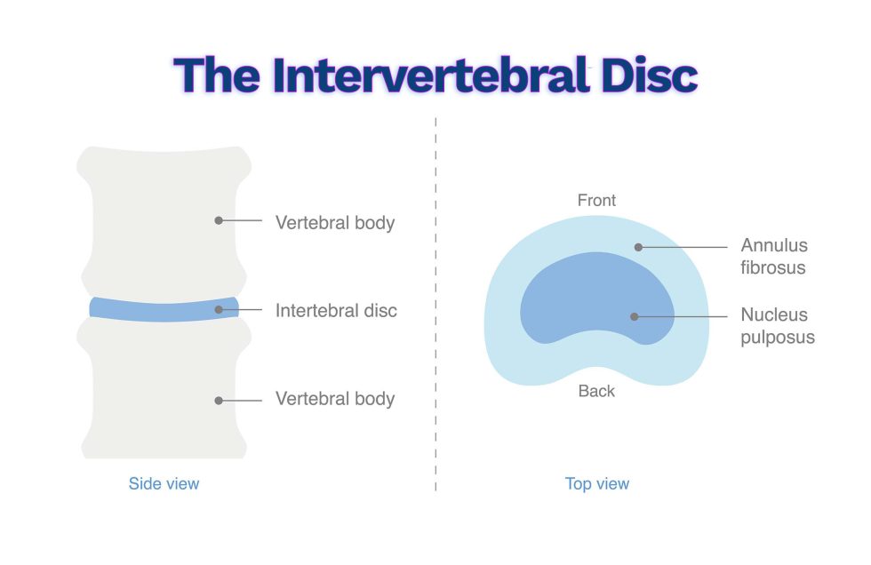 The Intervertebral Disc | Gwinnett Chiropractic